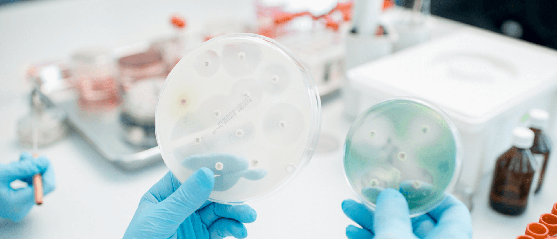 Microbiology (BSc) | Explore UM | University of Manitoba