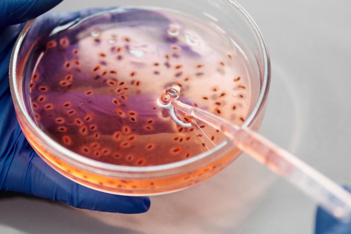 Biochemistry (BSc) | Explore UM | University of Manitoba