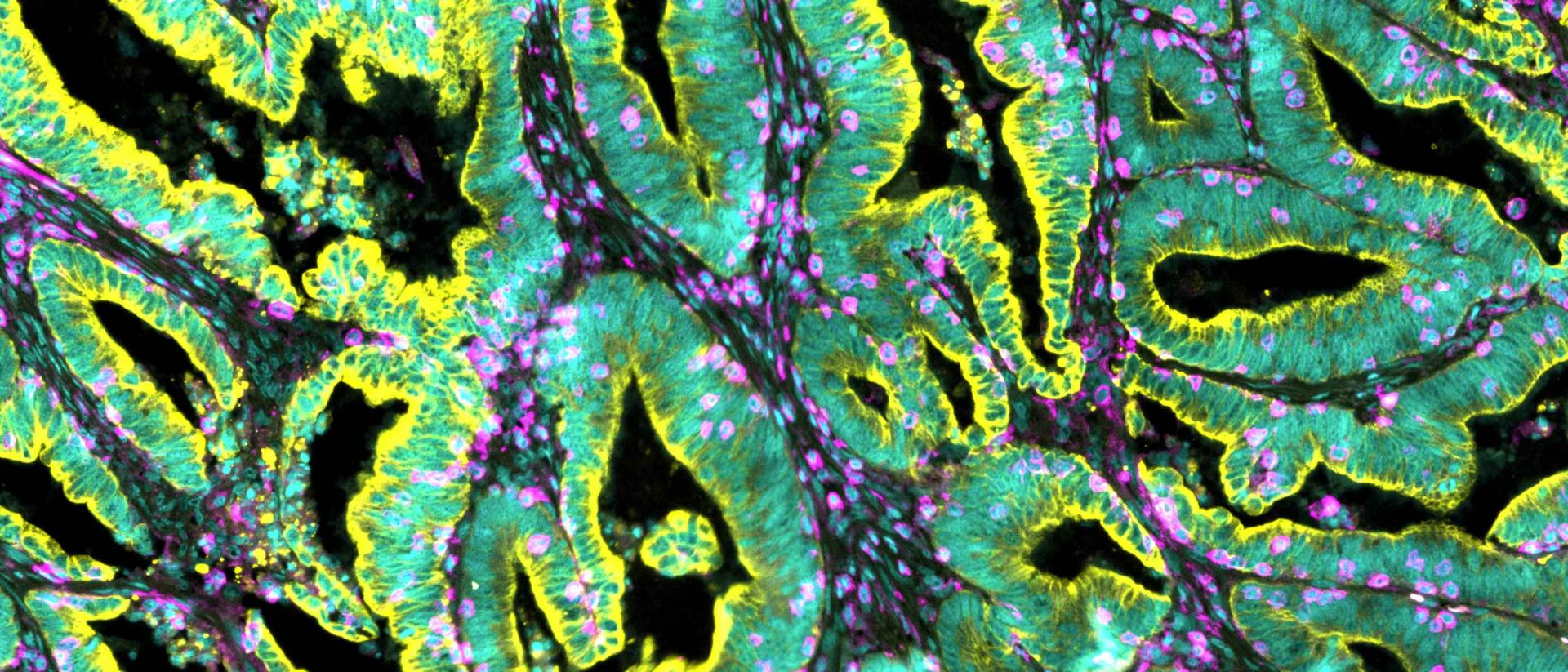 Pathology and Laboratory Medicine (PhD) | Faculty of Graduate and ...