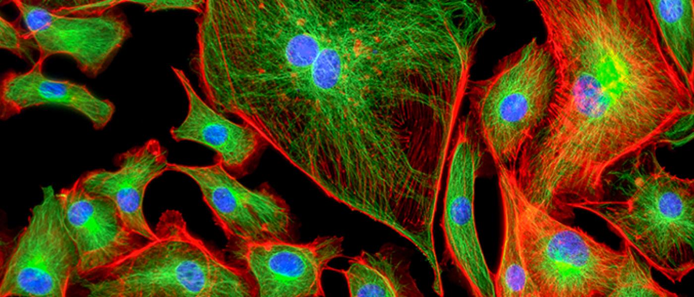 Live-Cell Imaging Facility | Rady Faculty of Health Sciences ...