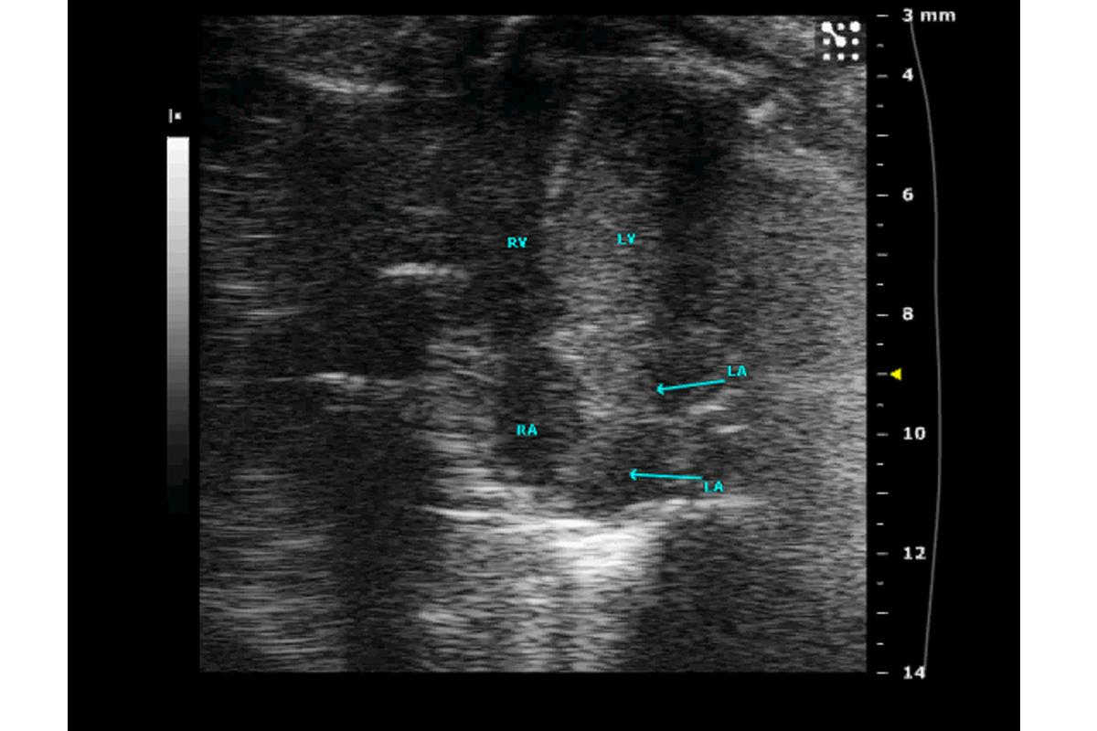 Ultrasound imaging | Rady Faculty of Health Sciences | University of ...