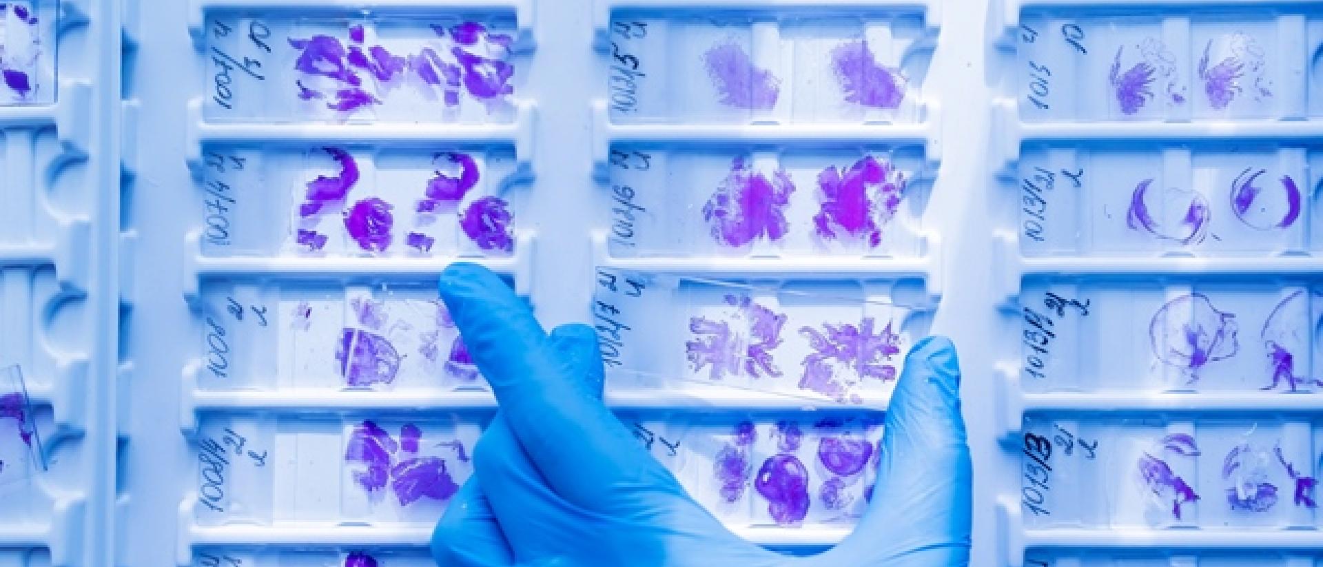 Diagnostic and Molecular Pathology | Max Rady College of Medicine ...